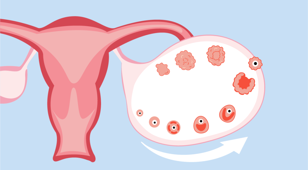 Follicle Stimulating Hormone (FSH) and Fertility: Premom